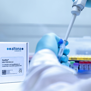 altona Diagnostics GmbH als Arbeitgeber 💊 Dein Überblick 2026